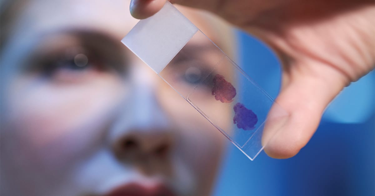 The way forward in cancer diagnostics and care | Lombard Odier